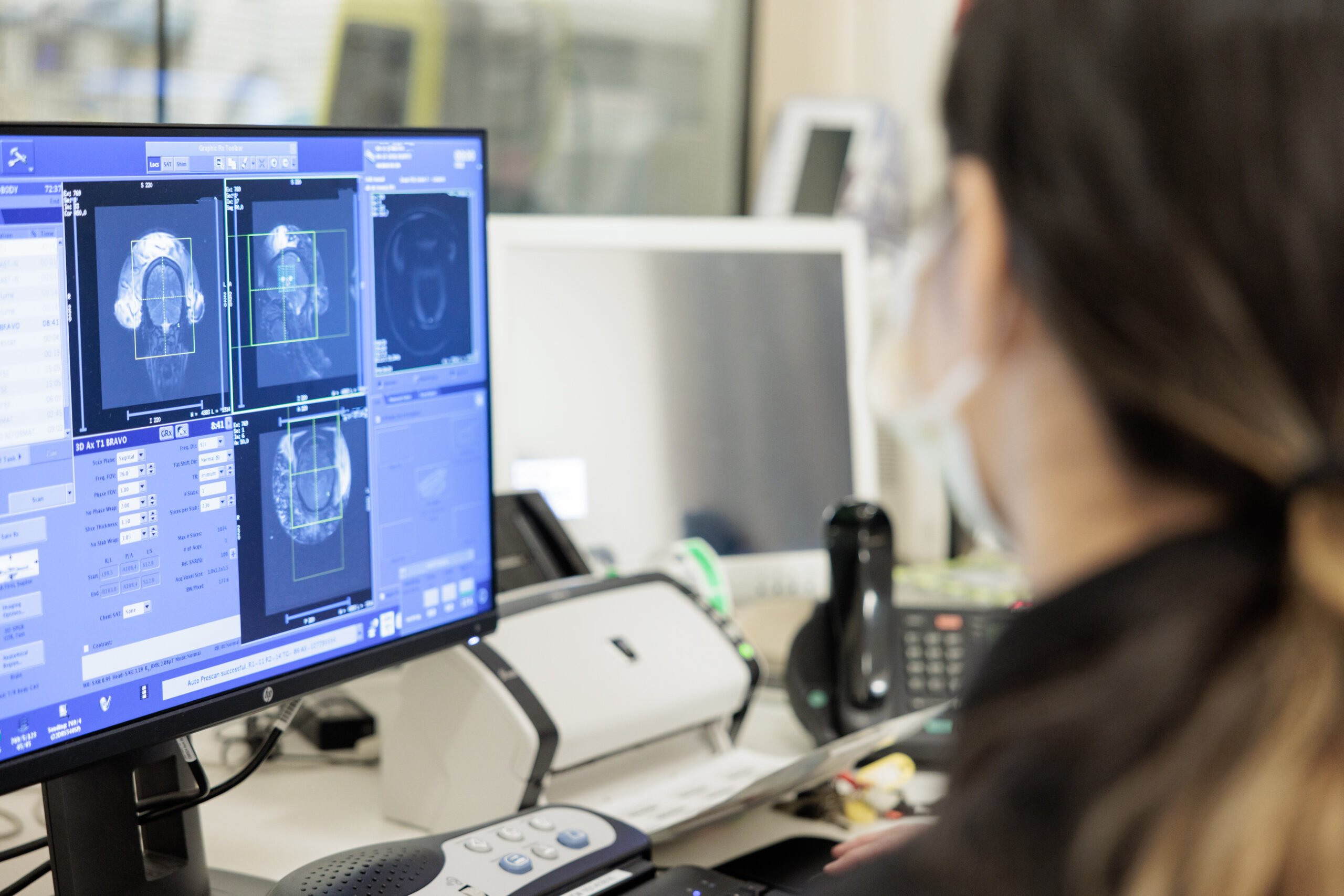 Focused Ultrasound for Parkinson's and Essential Tremor - Barrow Neurological Institute