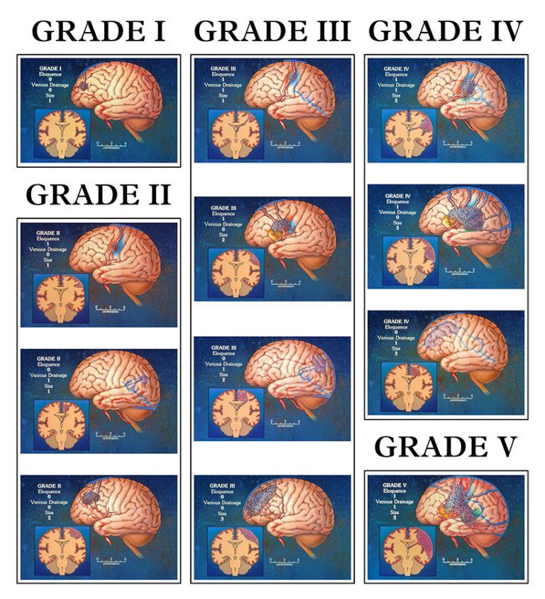 Dr. Robert F. Spetzler Makes Neurosurgery History as Two-Time CNS ...