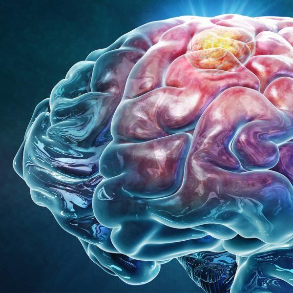 Brain Tumors - Symptoms, Diagnosis, and Treatment