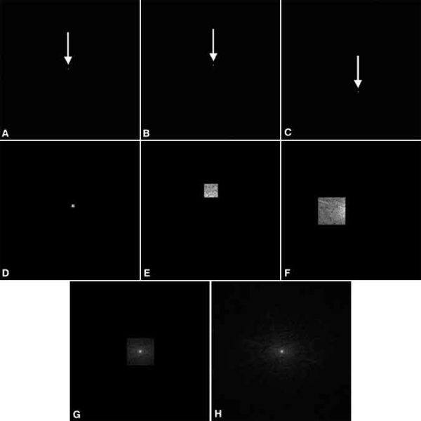 Basics of Magnetic Resonance Imaging - Barrow Neurological Institute