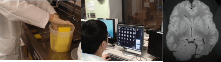 Racette Laboratory - Barrow Neurological Institute