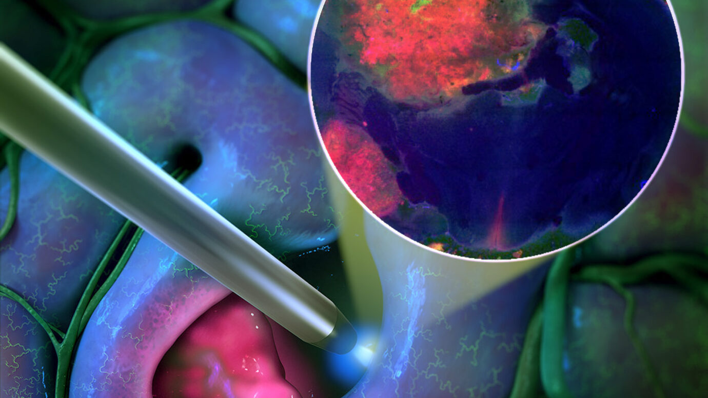 Pioneering Device May Advance Neurosurgery, Researchers Say