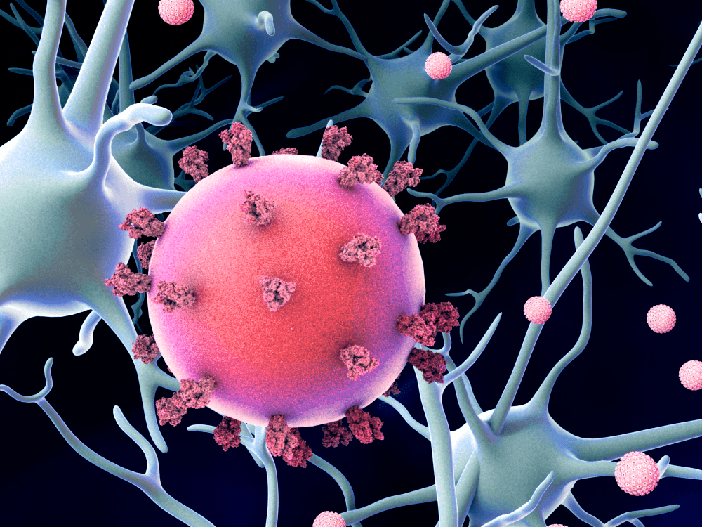 Study: COVID-19 Patients Have Had Strokes, Other Neurological Ailments Study: COVID-19 Patients Have Had Strokes, Other Neurological Ailments