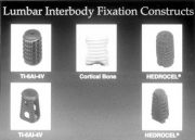 Internal Fixation and Fusion of the Lumbar Spine Using Threaded ...