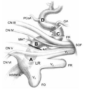 Microsurgical Anatomy of the Cavernous Sinus | Barrow Neurological ...