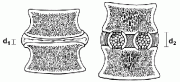 Internal Fixation and Fusion of the Lumbar Spine Using Threaded ...