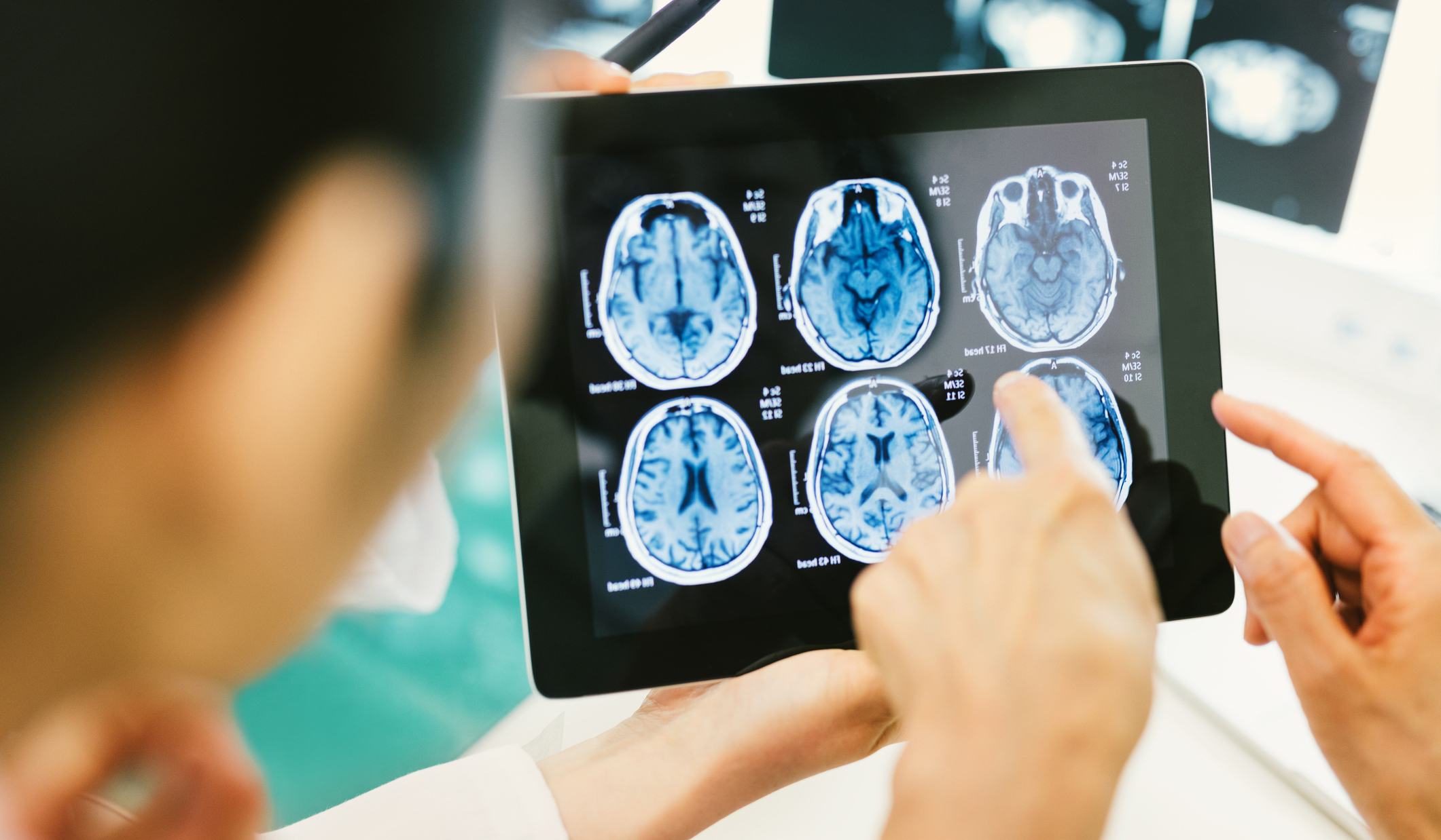 Imbalance Symptoms and Treatment | Barrow Neurological Institute