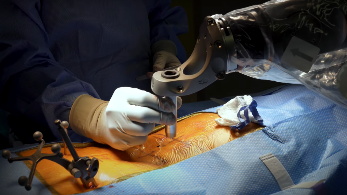 Robotic Spine Surgery Explained