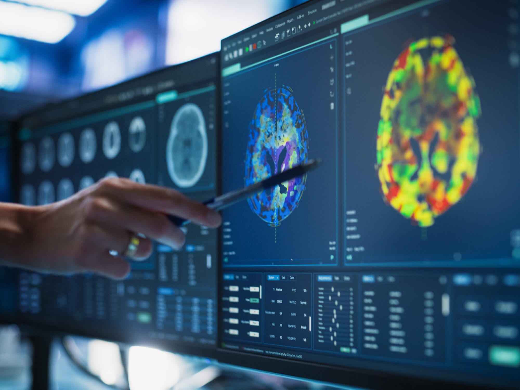 Barrow Neuro Analytics Center - Barrow Neurological Institute